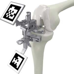 Pixee Medical | United Orthopedic UK